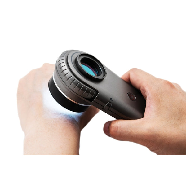 Illuco IDS-1100 Dermatoscope – GENTREX INTERNATIONAL MEDICAL SUPPLIES ...